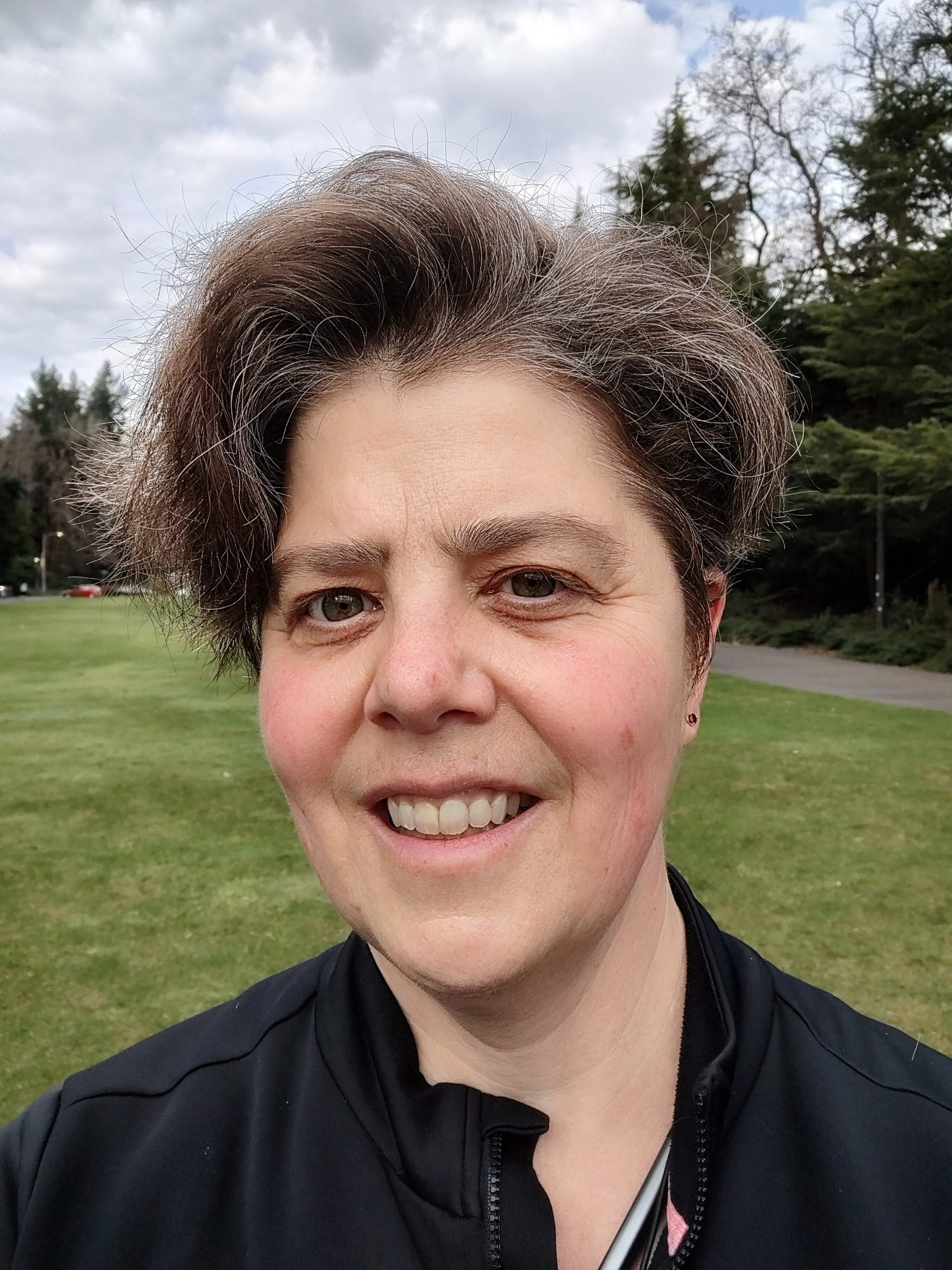 Our UW Team – HDSA Center of Excellence