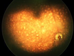 Team aims to illuminate cause of rare blinding disease – Kelly Lab