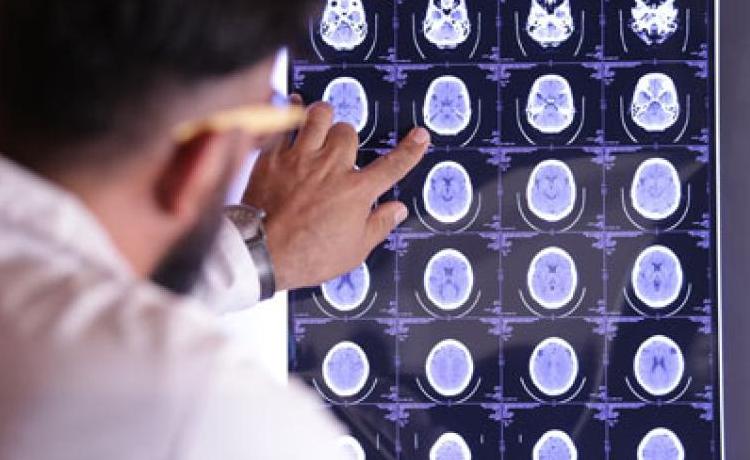 Memory and Brain Wellness Center