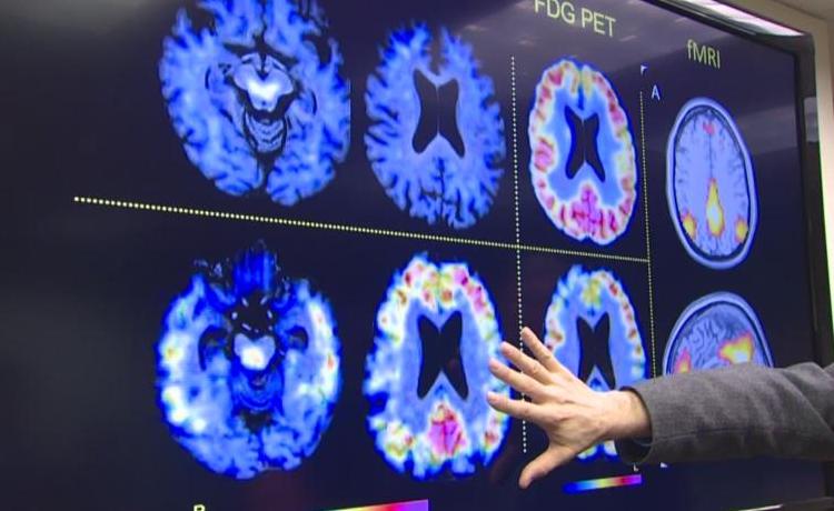 Memory and Brain Wellness Center