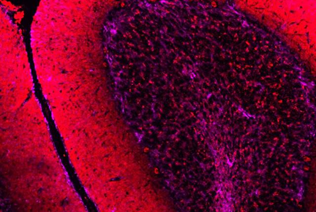 The cerebellum’s role in Alzheimer’s - Memory and Brain Wellness Center