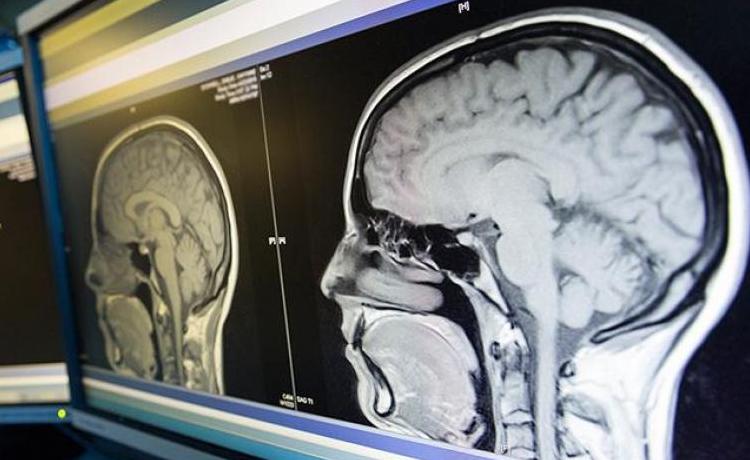 Memory and Brain Wellness Center