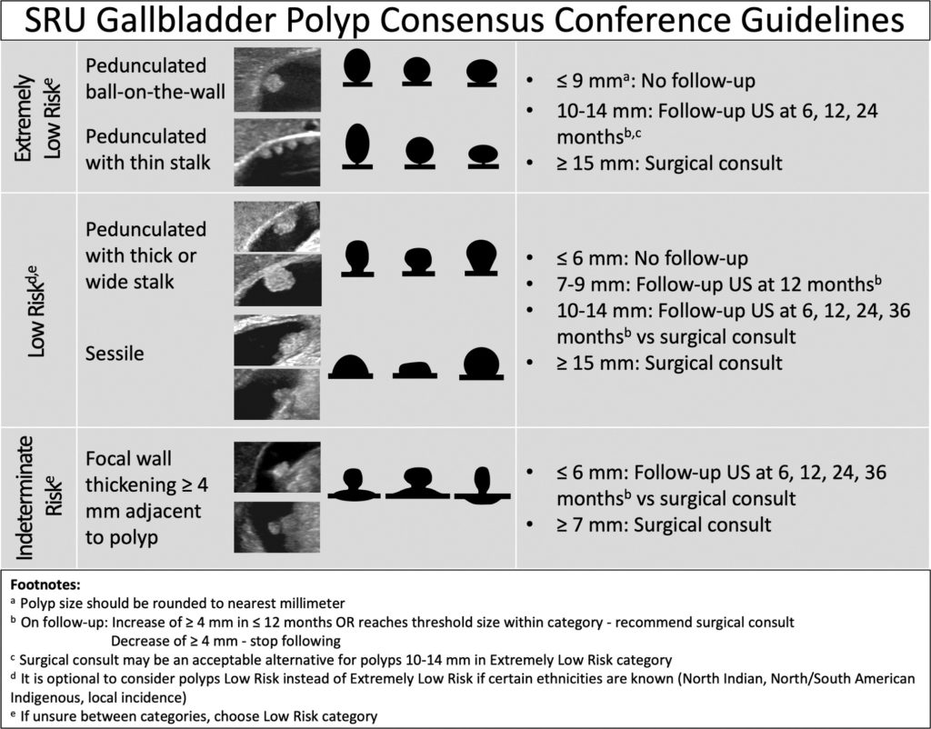 Gallbladder Polyp Guidelines – SRU | UW Ultrasound Gallbladder Polyp Guidelines – SRU | UW Ultrasound